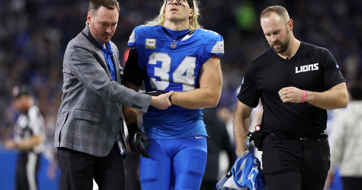 Michigan doctor speaks on Alex Anzalone's forearm injury - CBS Detroit
