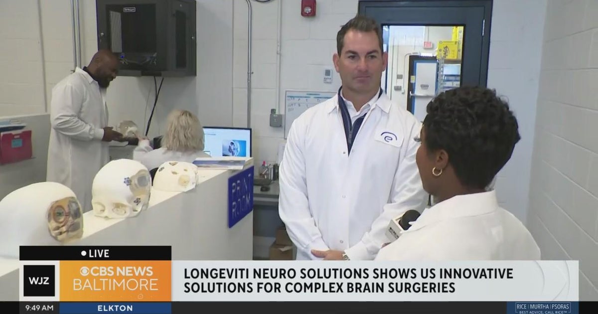 Where's Miana? Learning about innovative brain surgeries at Longeviti ...