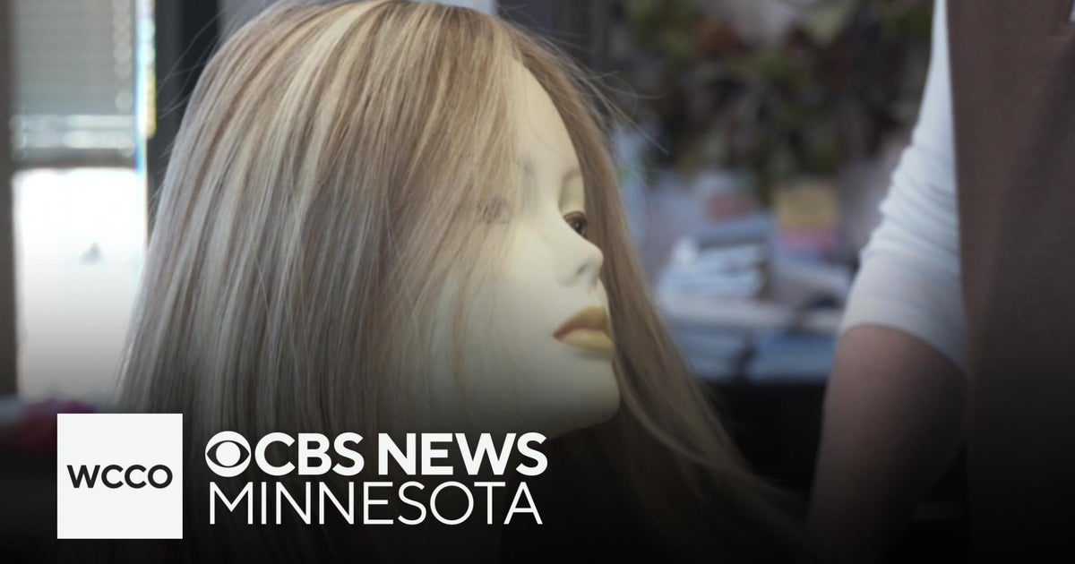 Cost of some wigs to be covered by insurance under Minnesota law going ...
