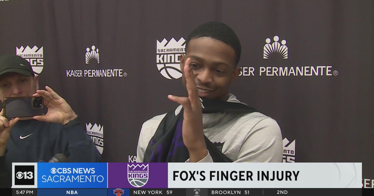 Kings' Fox shows off finger injury ahead of Wednesday's Warriors ...