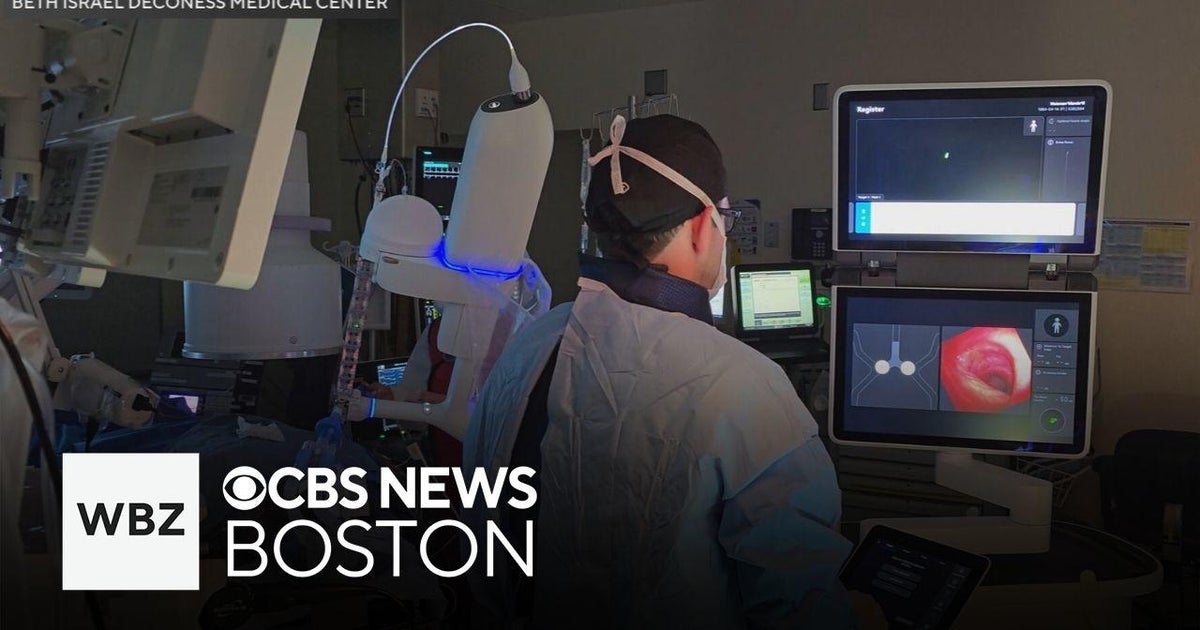 Boston hospital pioneers new, easier lung cancer treatment - CBS Boston