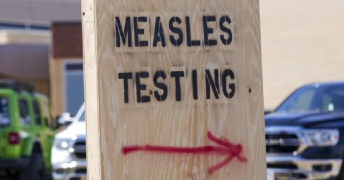 Texas reports first death in Measles outbreak - CBS News