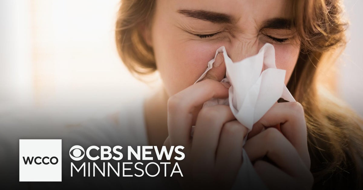Here's what happens in your body when you sneeze - CBS Minnesota