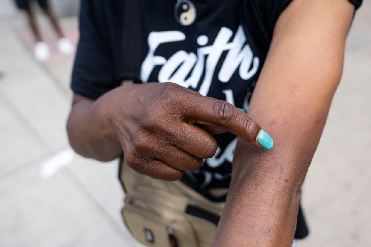 Woman's survival in Baltimore mass overdose spurs push for recovery ...