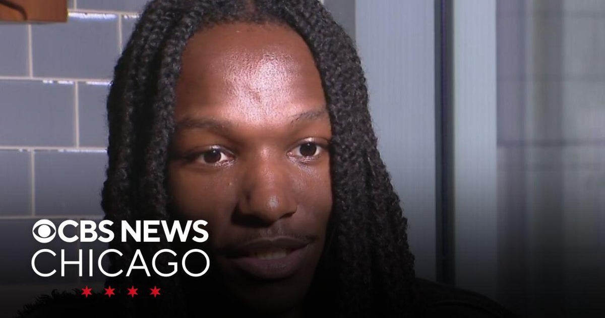 Survivor of gastroschisis, a rare genetic condition, aims to inspire ...