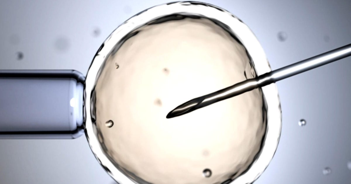 The science and ethics behind genetic embryo screening - CBS News