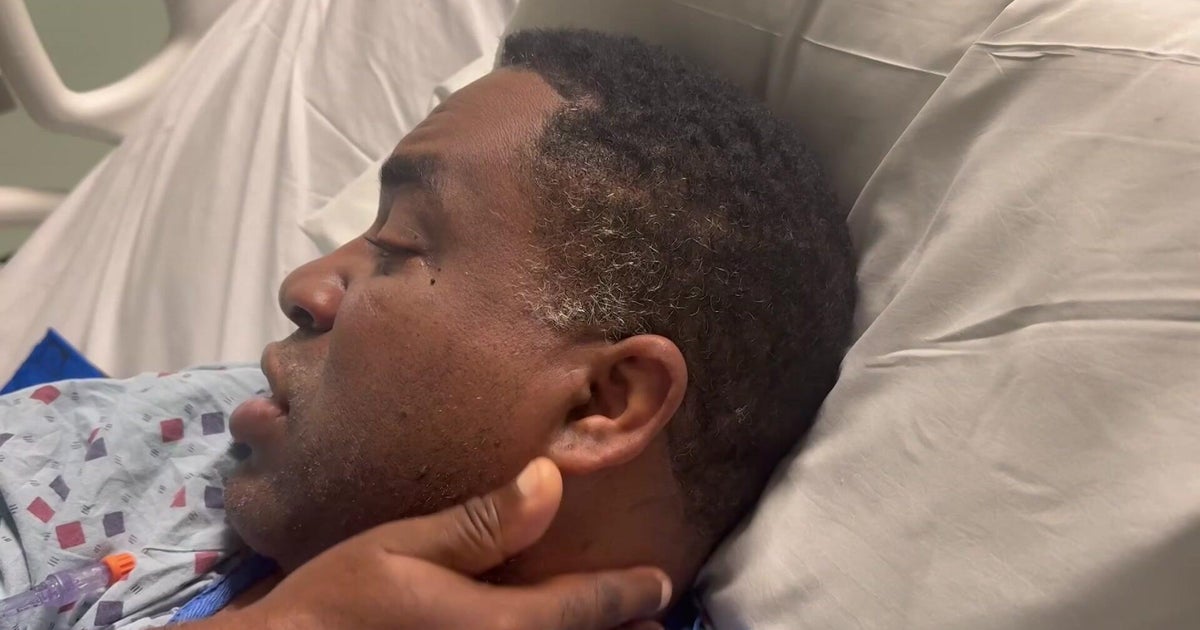 Man files NYPD complaints after suffering brain bleed in altercation ...