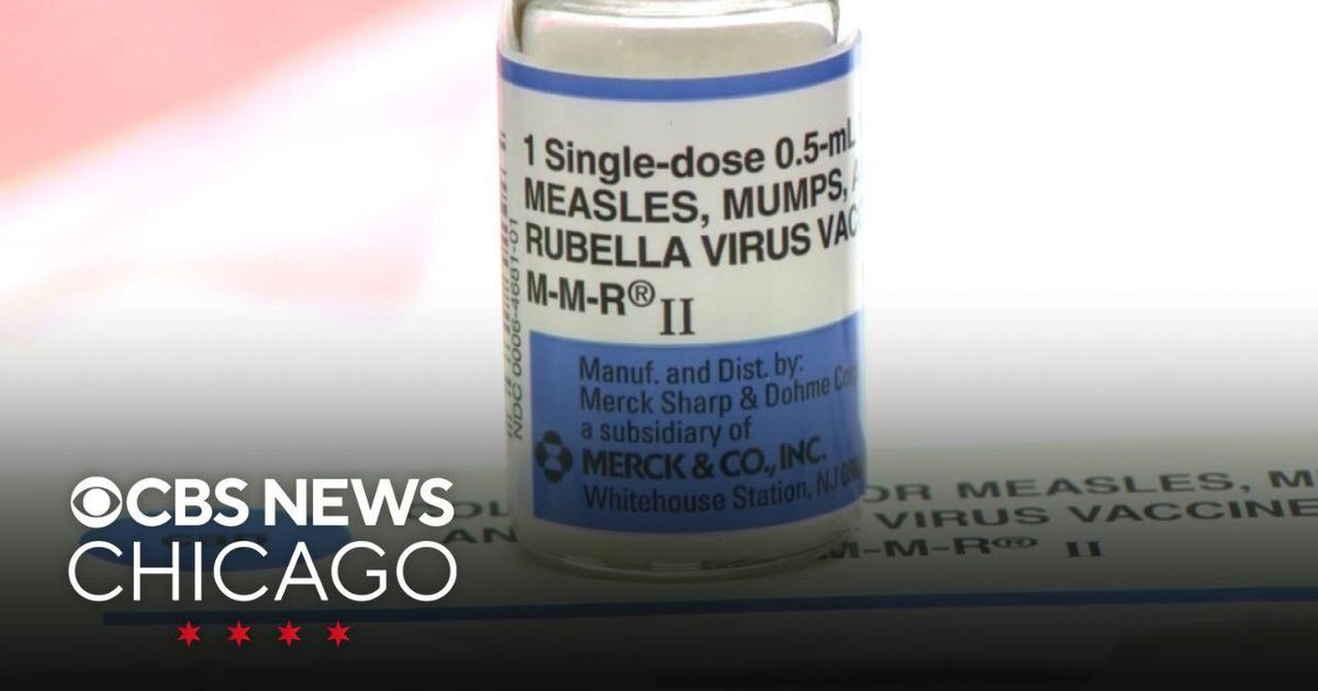 CDC vaccine committee changes recommendations on MMRV vaccines - CBS ...
