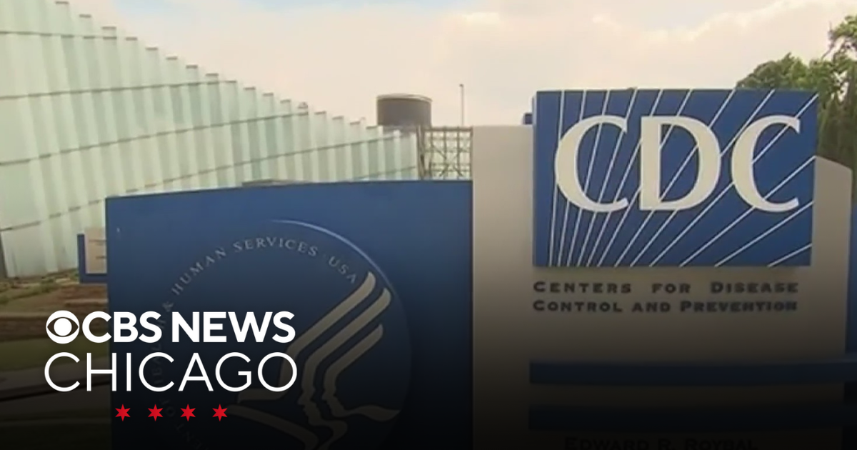CDC calls for measles, mumps, and rubella shots to be separate - CBS ...