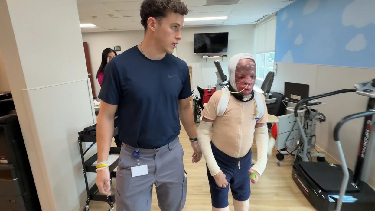 10-year-old burned in Philadelphia plane crash closer to coming home ...