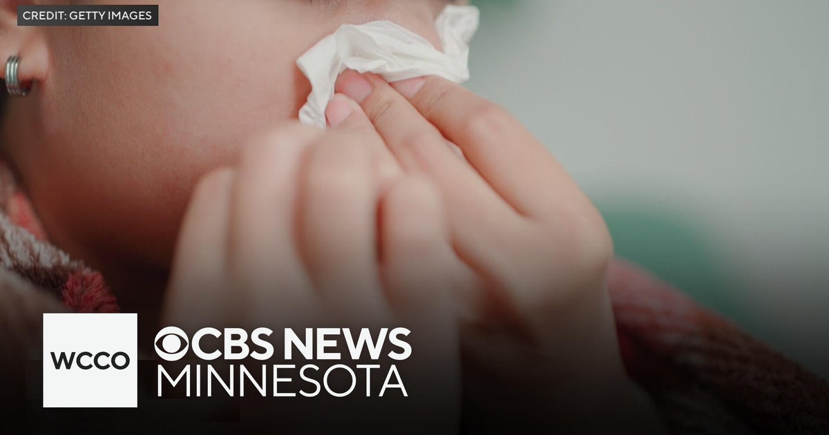 Flu season already in full swing in Minnesota - CBS Minnesota