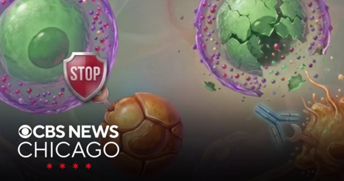 Northwestern Medicine trialing new antibody therapy in fight against ...