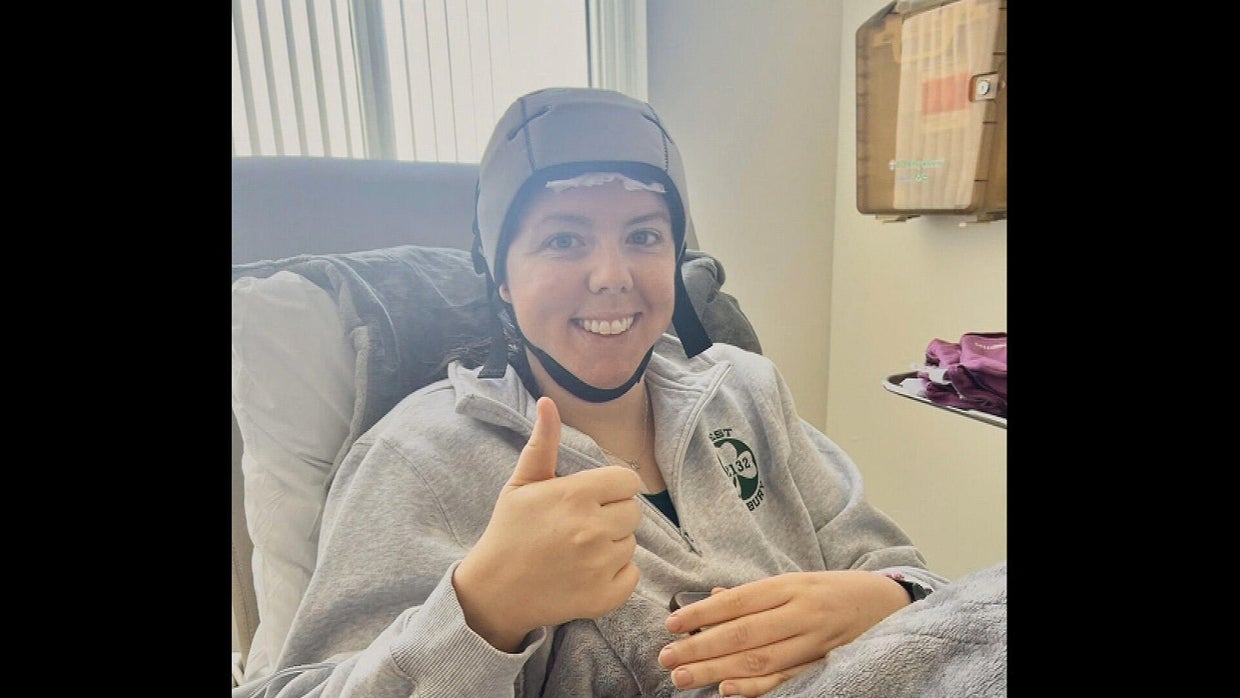 Cold cap helped Massachusetts mom keep hair during chemo. Now she is ...