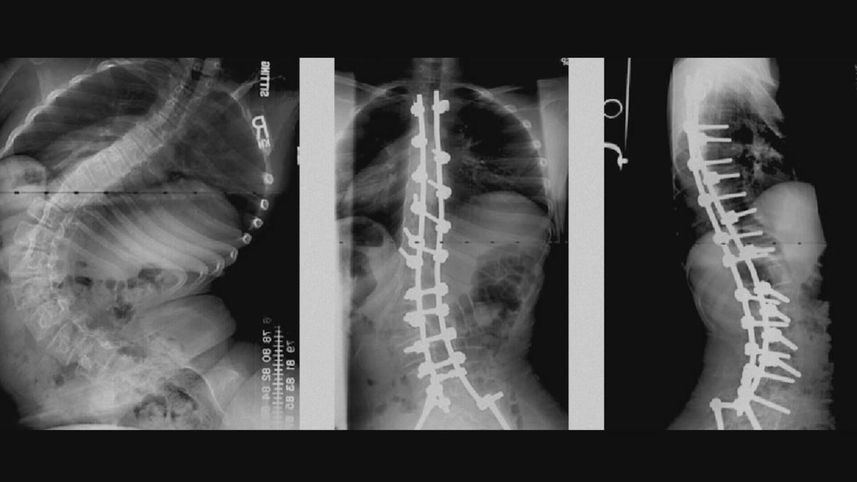 Final wish denied as Colorado ALS patient's access to experimental drug ...