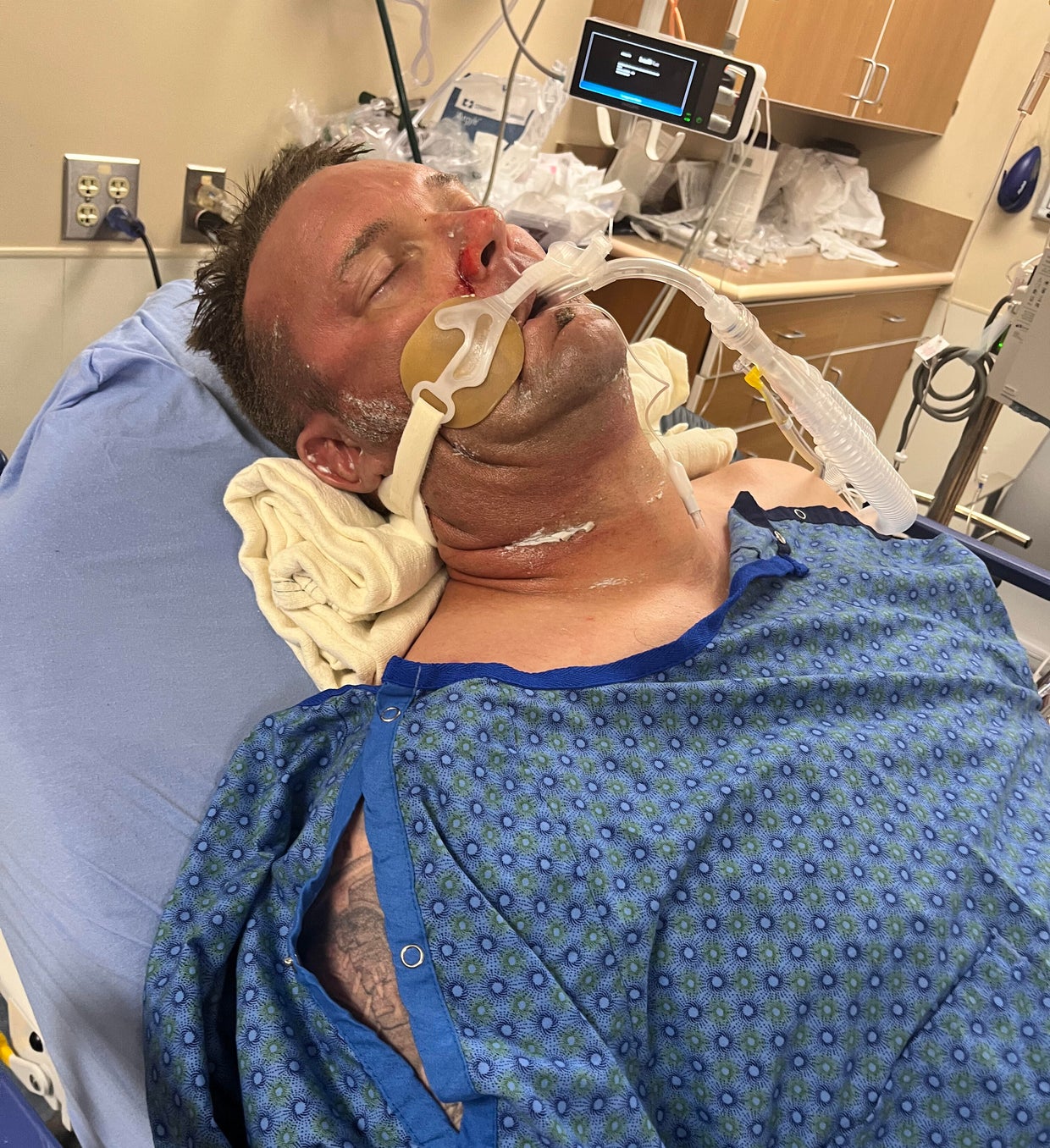 "You have about 10 minutes to live": Colorado rancher shares story of ...