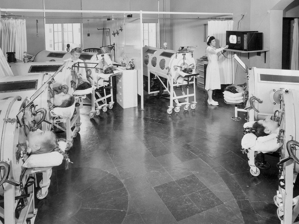 How safe is America from polio? - CBS News