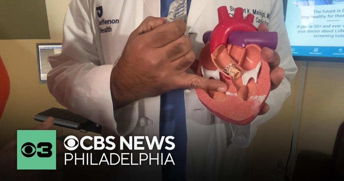This pacemaker-like device is helping save heart disease patients ...