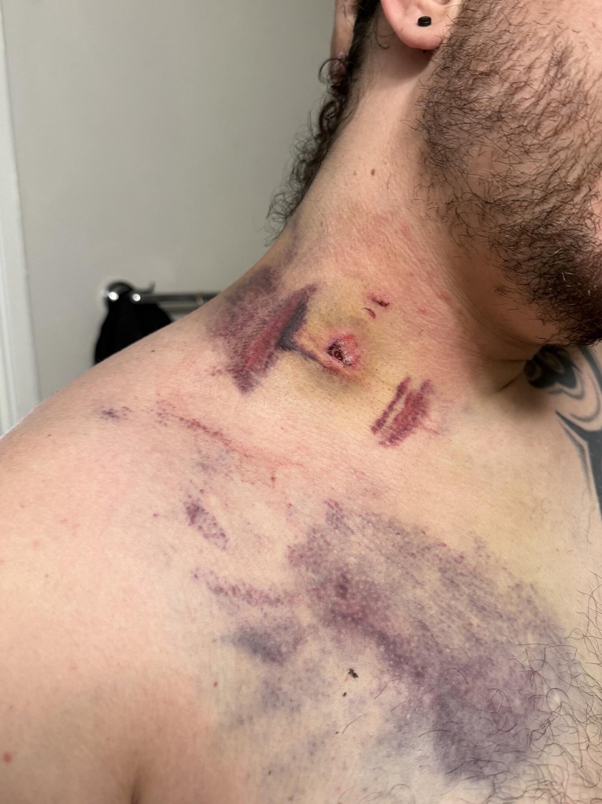 Man survives being shot in the neck in Denver; suspect facing attempted ...