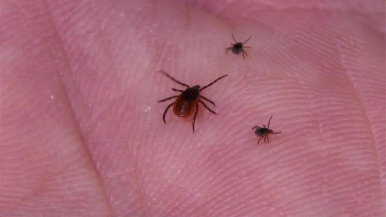 Long Island man survives extremely rare, tick-borne Bourbon virus. Why ...